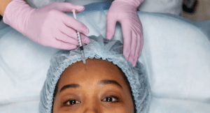 Botox for Beginners: 5 Things You Should Know - KULFIY.COM